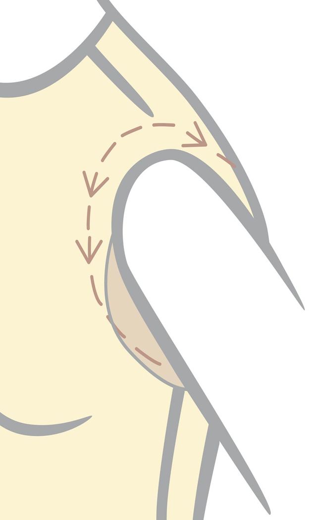 To Get the Right Armhole, Fit the Bodice - Threads
